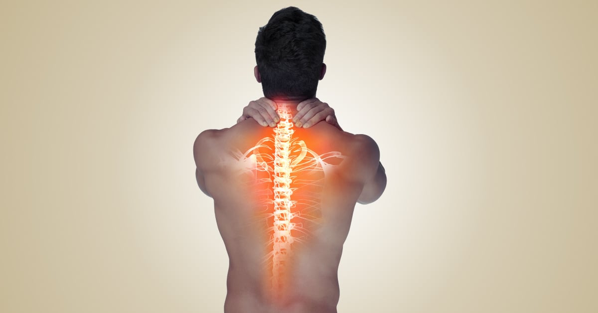 Neck pain radiating down the arm (Radicular pain), with or without ...