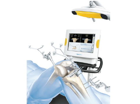 Computer-Assisted Navigation in TKA - Bumrungrad Hospital Bangkok